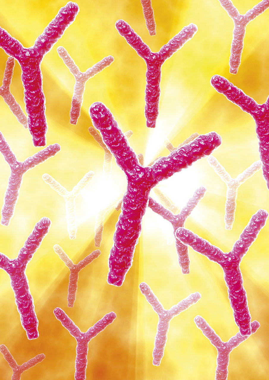 Gammapathies monoclonales | La Revue du Praticien